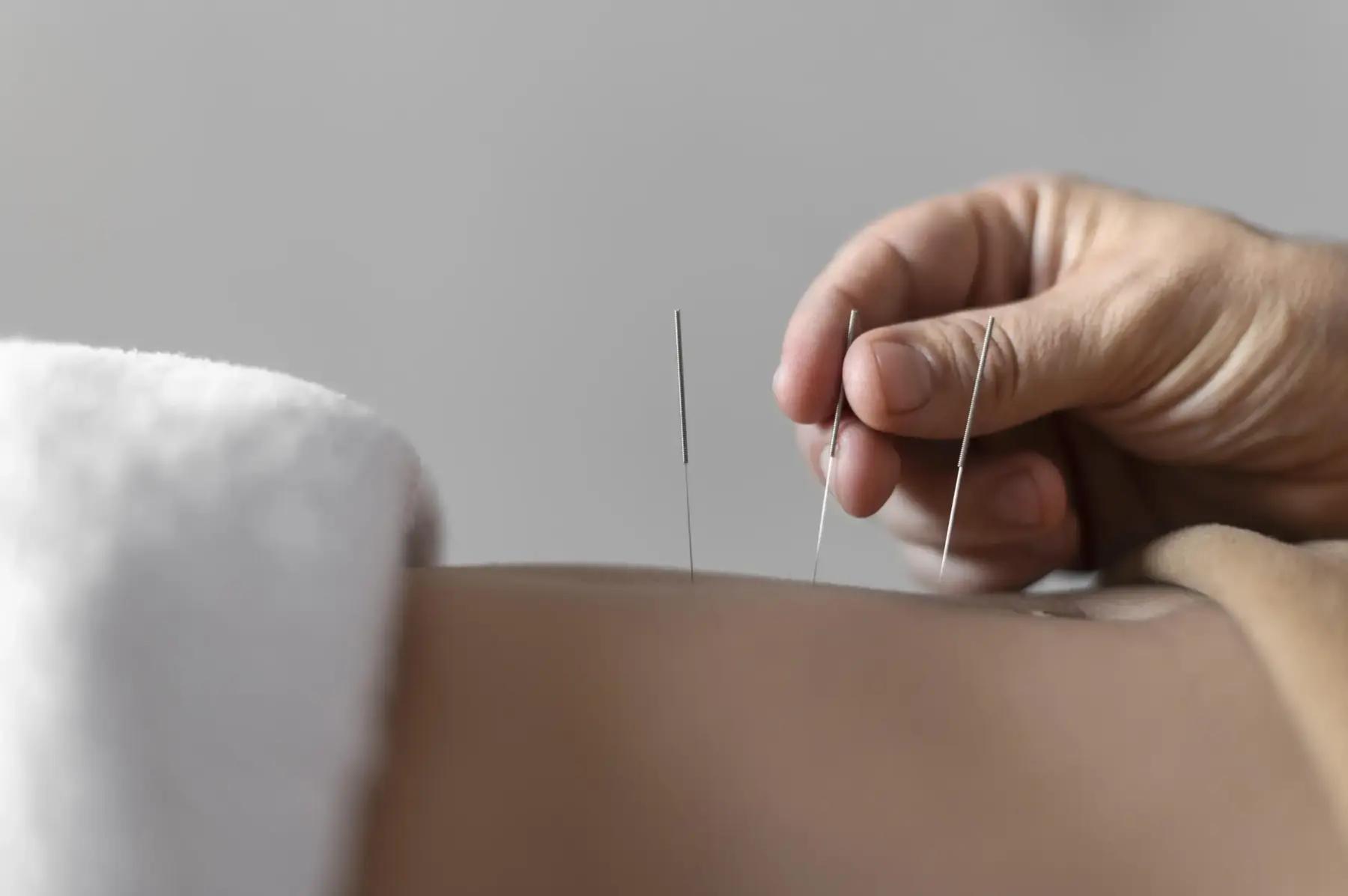Dry Needling In Stoneham | Boston Health & Wellness